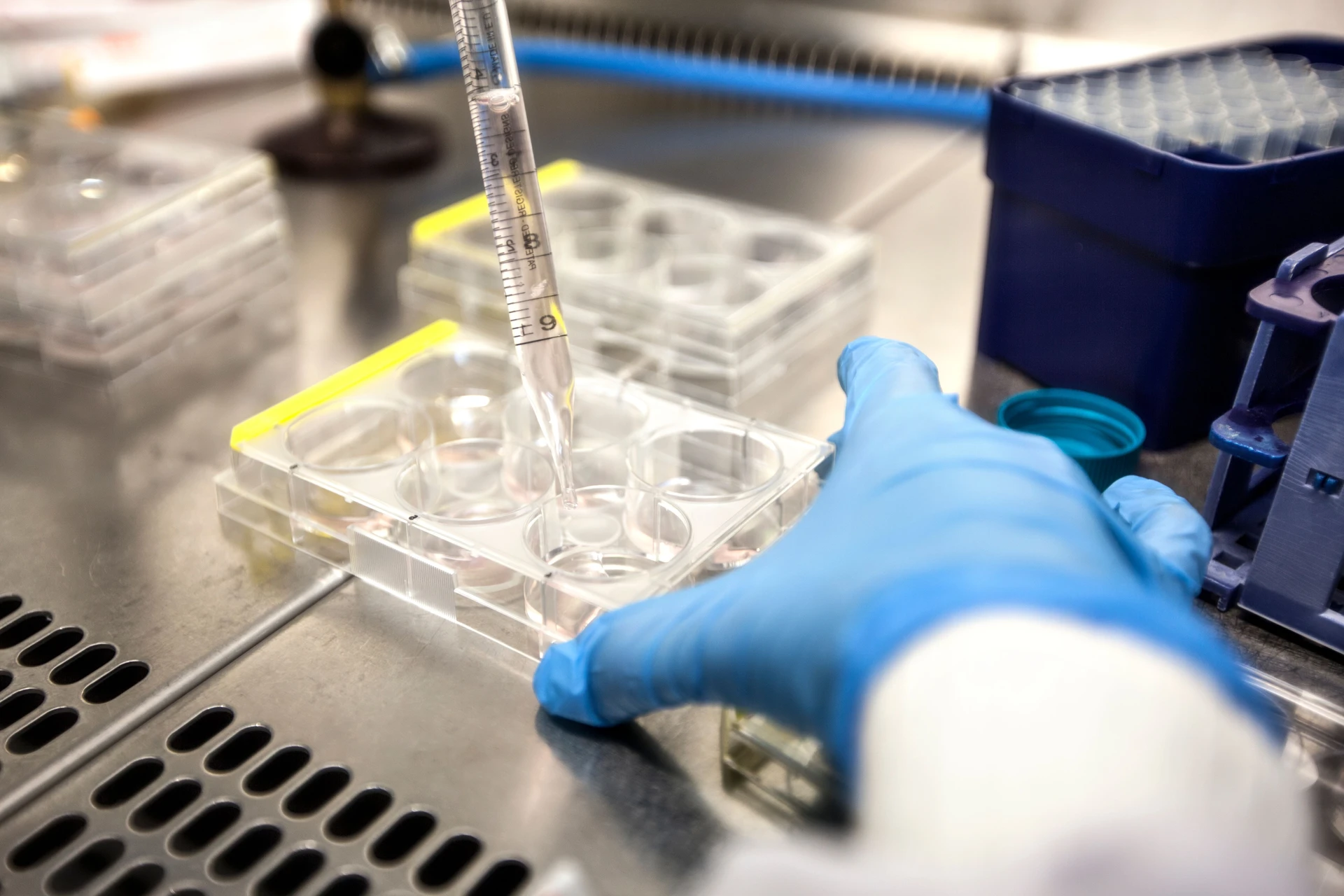 Platelet-Rich Plasma (PRP) Treatment in Fertility | Shradha IVF
